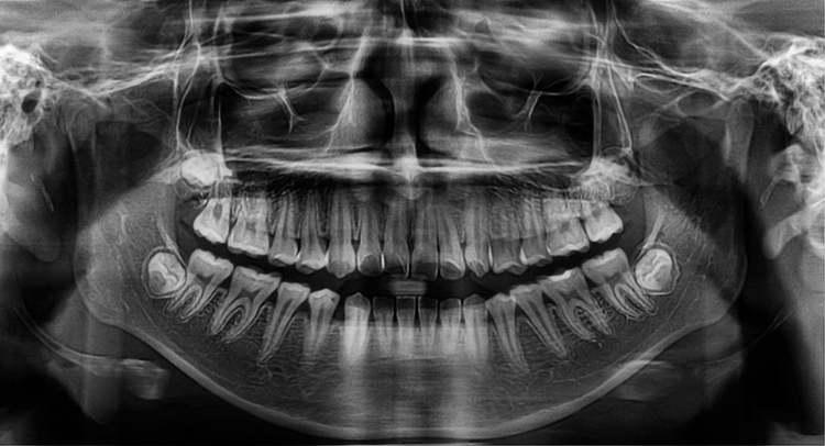 Dentistry Missoula | Advanced Dental Care MT | Dental Office 59803 ...